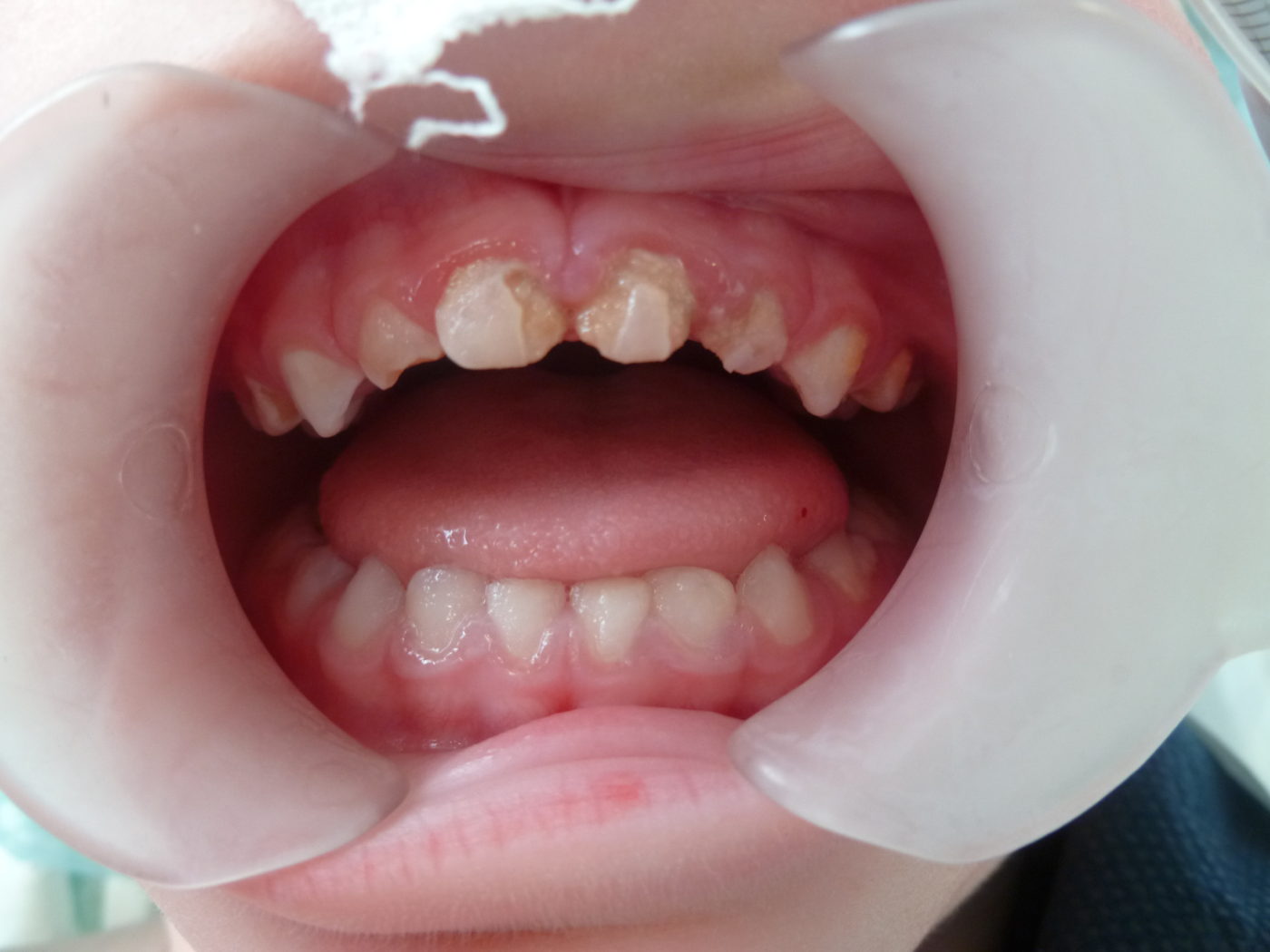 Première dent, premier brossage