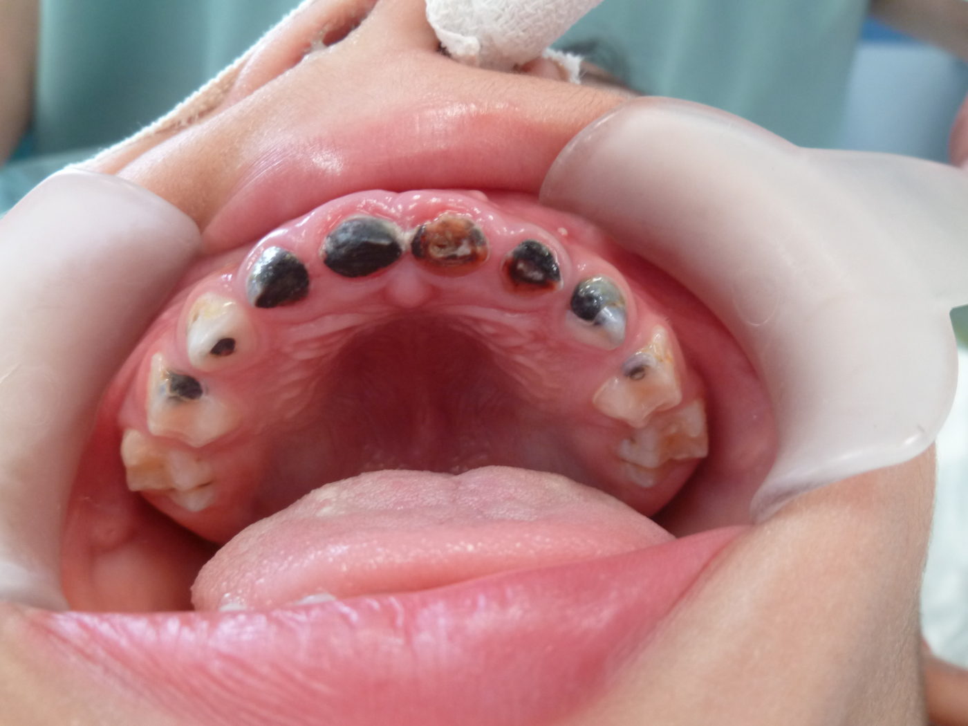 Première dent, premier brossage